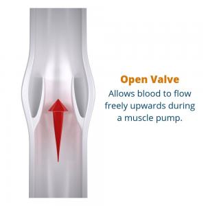 What are Valves in Veins and How do They Work - USA Vein Clinics