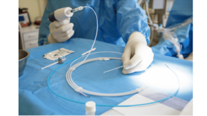 Vein Ablation For Varicose Veins: Pain Expectations And Treatment Overview