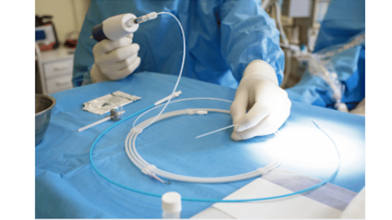 Vein Ablation For Varicose Veins: Pain Expectations And Treatment Overview