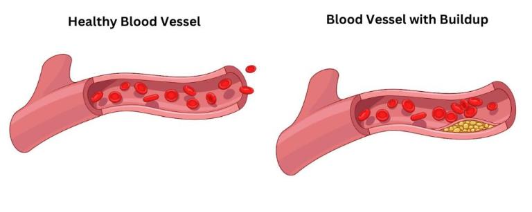 What Are Blood Vessels And How Do They Work?